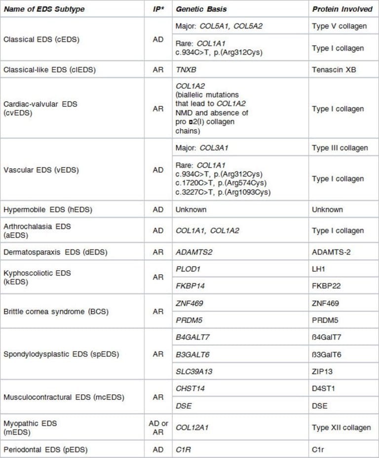 Ehlers-Danlos Syndrome Symptoms, Diagnosis, And Treatment Options | CHARM